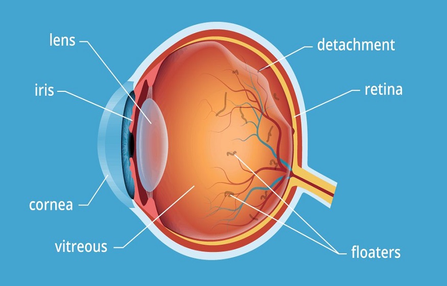 Learn About Floaters In The Human Eye's | Mustereklerimiz.org